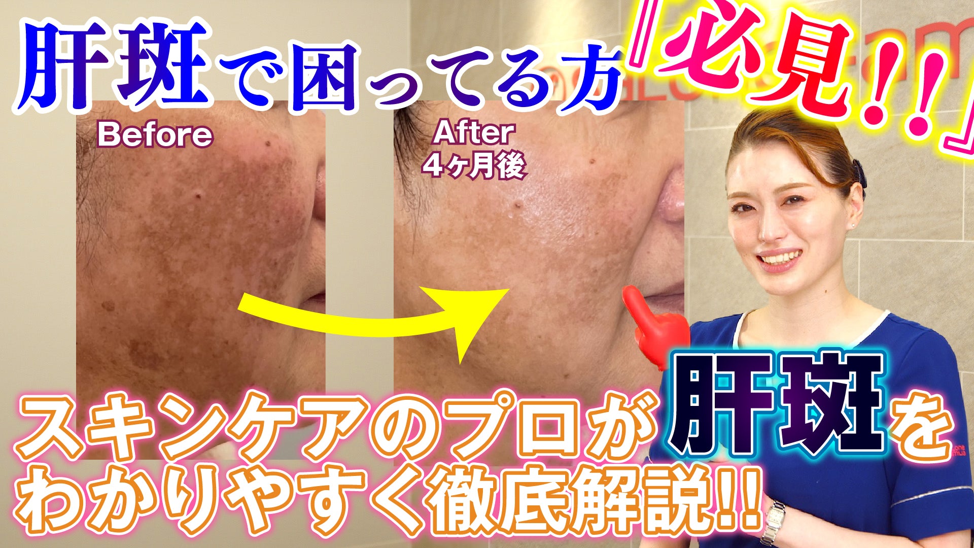 VOL.99 【肝斑 徹底解説‼️】 – SALONE FAMILIA OnlineStore